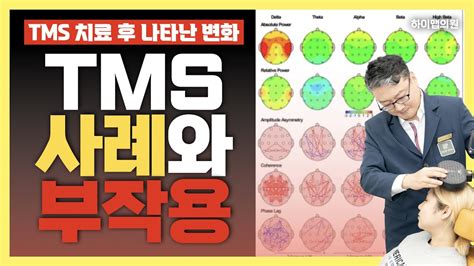 네이버 인플루언서