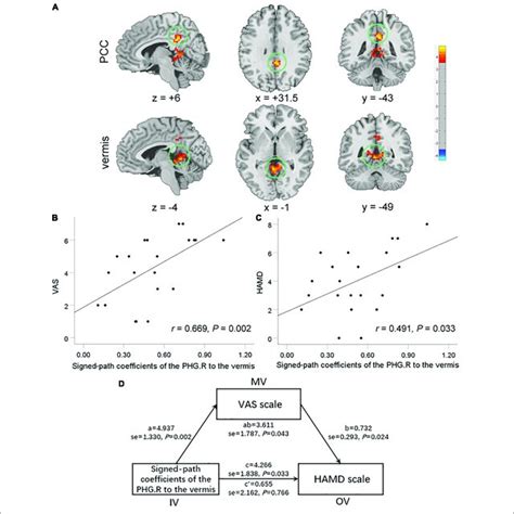 Brain Regions Exhibiting Enhanced Functional Connectivity Fc With