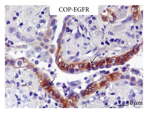 Representative Tissue Microarray Section Immunostained With Monoclonal