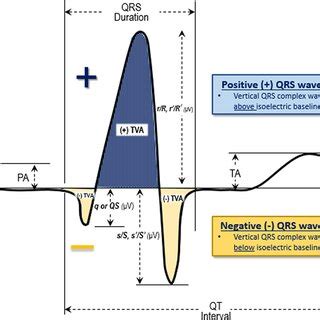 QRS Complex Waveform Measurements Schematic Representation Of A
