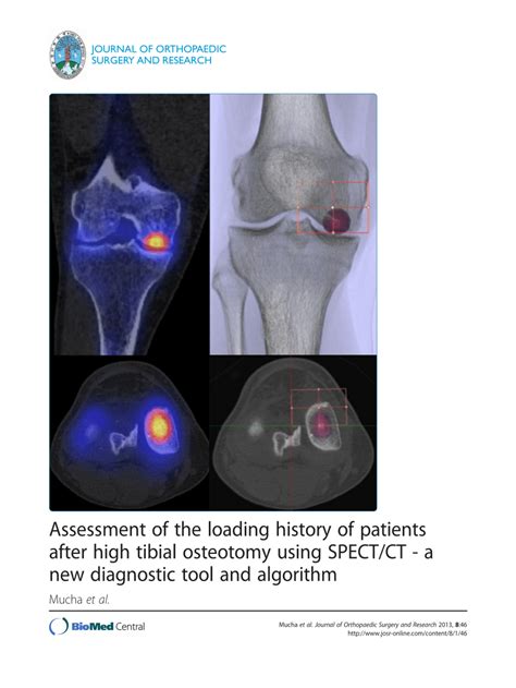 Pdf Assessment Of The Loading History Of Patients After High Tibial Osteotomy Using Spectct