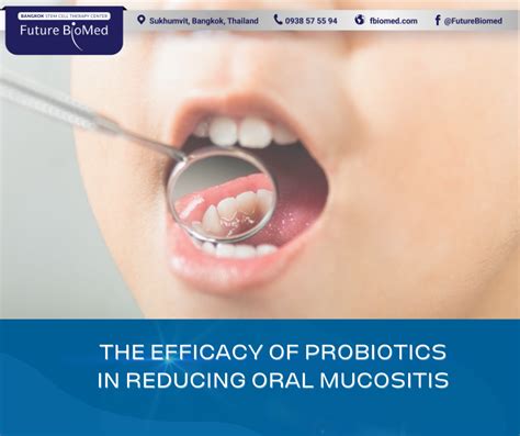Probiotics Applications In Treating Oral Mucositis Future Biomed Clinic And Lab