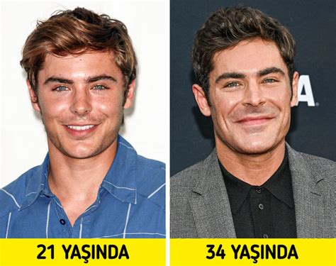 Zac Efron Yüzüne Gerçekten Ne Olduğunu Açıklıyor Ve Estetik Ameliyat Söylentilerini Yanıtlıyor