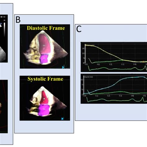 Dynamic Automated Evaluation Of The Lv And La Volumes And Function Download Scientific Diagram