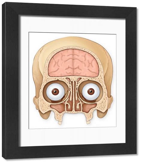 Prints Of Normal Coronal Section Of The Skull And Brain Showing The