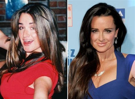 Kyle Richards Kyle Richards Plastic Surgery Plastic Surgery Kyle