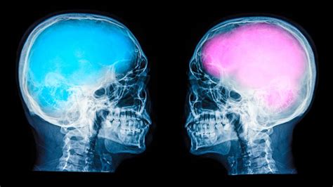 Theres No Such Thing As A Male Or Female Brain Study Finds