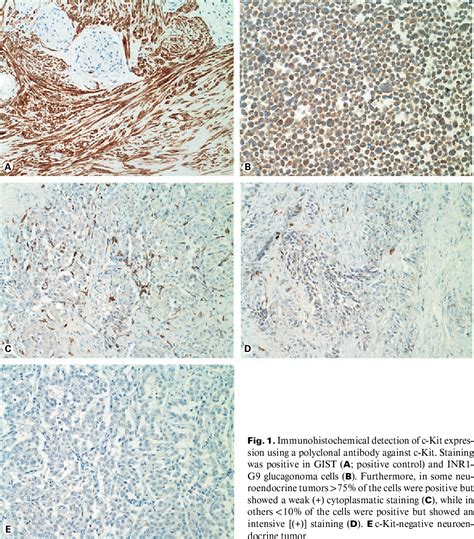 Figure 1 From Effects Of The Tyrosine Kinase Inhibitor Imatinib On