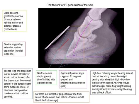 Healthy V Laminitic Foot The Laminitis Site