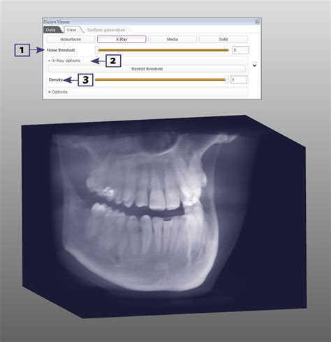 Exocad Wiki File RegistrazioneModelliExocadIta Exocad