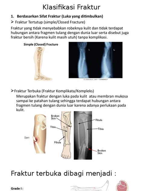 Klasifikasi Fraktur Pdf