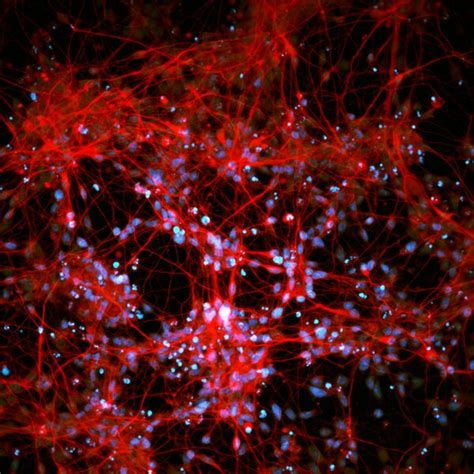 Human Ipsc Derived Neural Progenitor Kit Scr131