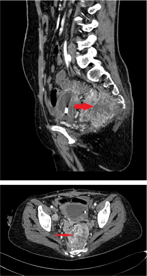 ct1 ct scan sagittal slice ct2 ct scan transversal slice