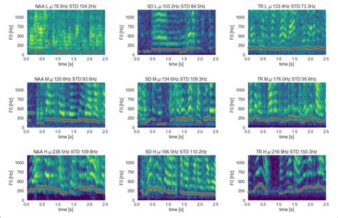 Spectrogram Representation Of Three Males Samples One For Each Download Scientific Diagram