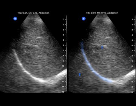 Pocus Flashcards Quizlet