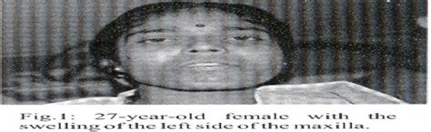 Journal Of Oral And Maxillofacial Pathology