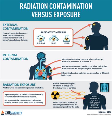 Radiation Exposure In Hospitals At Jaime Cardenas Blog