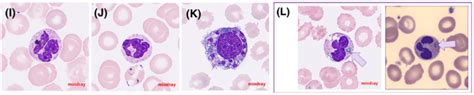Hemabook Chapter 23 Empowering Wbc Differential With Digital Morphology Mindray