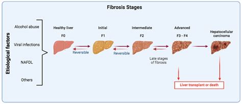 New Biomarkers In Liver Fibrosis A Pass Through The Quicksand