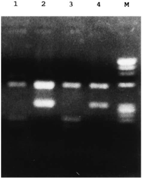 Restriction Endonuclease Digestion Of The Products Of Nested Pcr The
