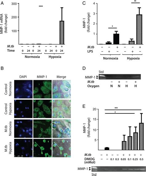 Hypoxia Increases Mycobacterium Tuberculosis M Tb Driven Matrix