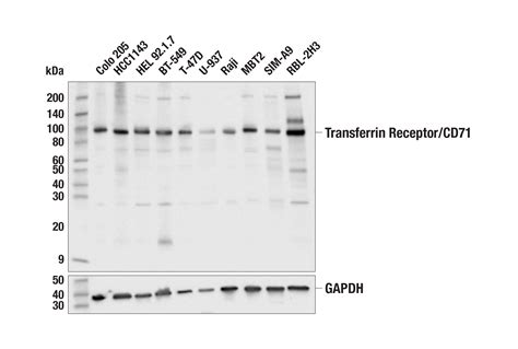 Labcorp Test Code For Beta 2 Transferrin At Hamish Geake Blog