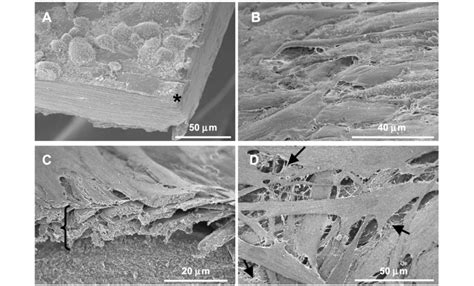 Scanning Electron Micrograph Of Stromal Fibroblasts Seeded On A Download Scientific Diagram
