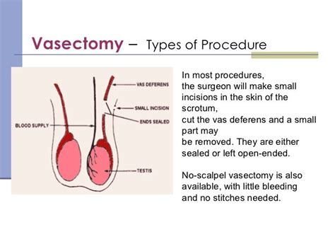 Birth Control Methods