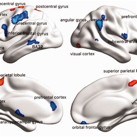 Global Functional Connectivity Density Alterations In Healthy Download Scientific Diagram