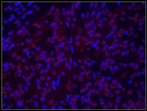 Cell Detection In Qupath Not Working Across Samples Image Analysis Imagesc Forum