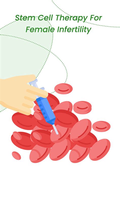 Stem Cell Treatment For Female Infertility 2023 All You Need To Know Clinicspots
