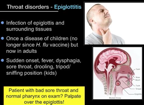 Tripod Position Epiglottitis