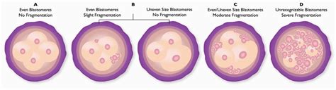 Embryo Grading Blastocyst Implantation Blastocyst Grading