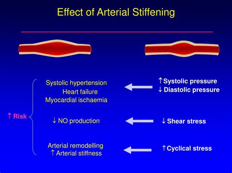 Ppt Vascular Compliance As A Novel Cardiovascular Risk Factor