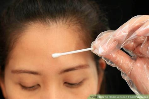 How To Remove Deep Facial Wrinkles With Pictures WikiHow