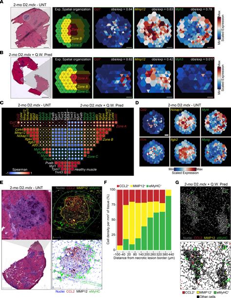 Spatiotemporal Transcriptomic Mapping Of Regenerative Inflammation In Skeletal Muscle Reveals A