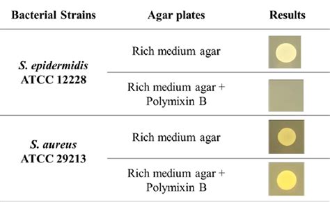 The Spot Appearances Of S Epidermidis And S Aureus On Rich Medium Download Scientific Diagram