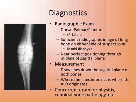 Angular Limb Deformity