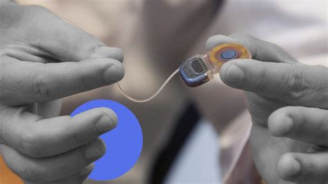 ¿qué Conmemora El Día Internacional Del Implante Coclear Mvs Noticias