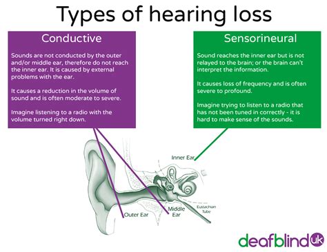 Describe The Difference Between Conductive Hearing Loss And