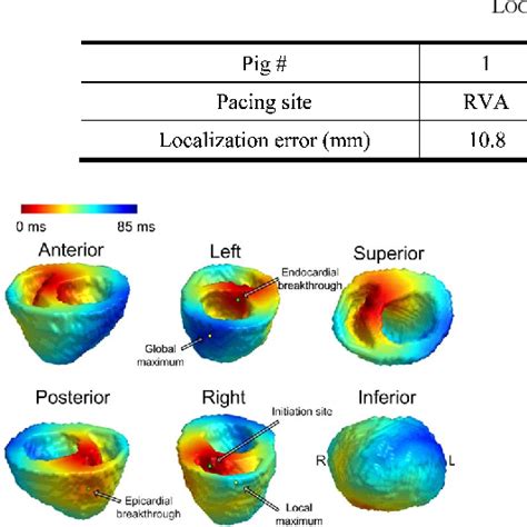 Figure 1 From Three Dimensional Imaging Of Ventricular Activation And