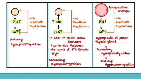 Hyperparathyroidism Imaging Metabolic Bone Disease Pptx