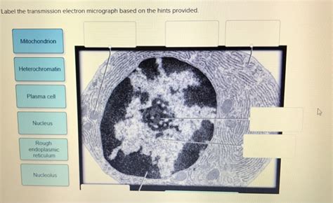 Solved Label The Transmission Electron Micrograph Based On