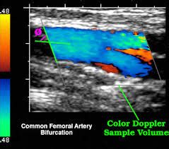 Color Doppler At Best Price In Secunderabad ID Medico Tec Achari Interiors