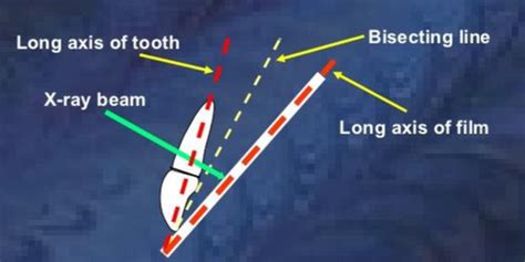 Bisecting Angle And Occlusal Technique Flashcards Quizlet
