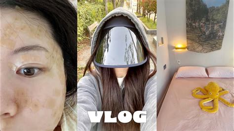 Vlog🏠 강제 집콕 어쩌다보니 편평사마귀 제거 브이로그 영이 Youtube