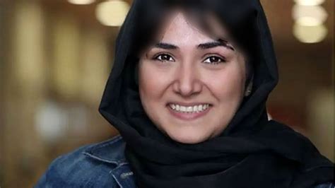 عکس چهره وحشتناک باران کوثری چه بلایی بر سر خانم بازیگر آمده