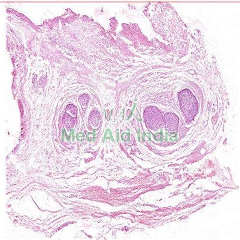 Peripheral Nerve T S Microscope Slides Manufacturer Supplier From Noida