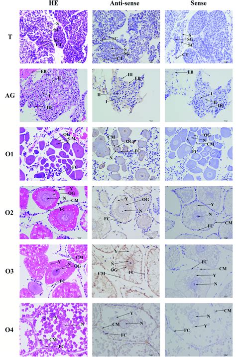 In Situ Hybridization Analysis Of Mn Sdhb Gene In Testis And Download Scientific Diagram