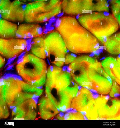 Throat Tissue Fluorescence Deconvolution Micrograph Of A Section Through Throat Tissue This